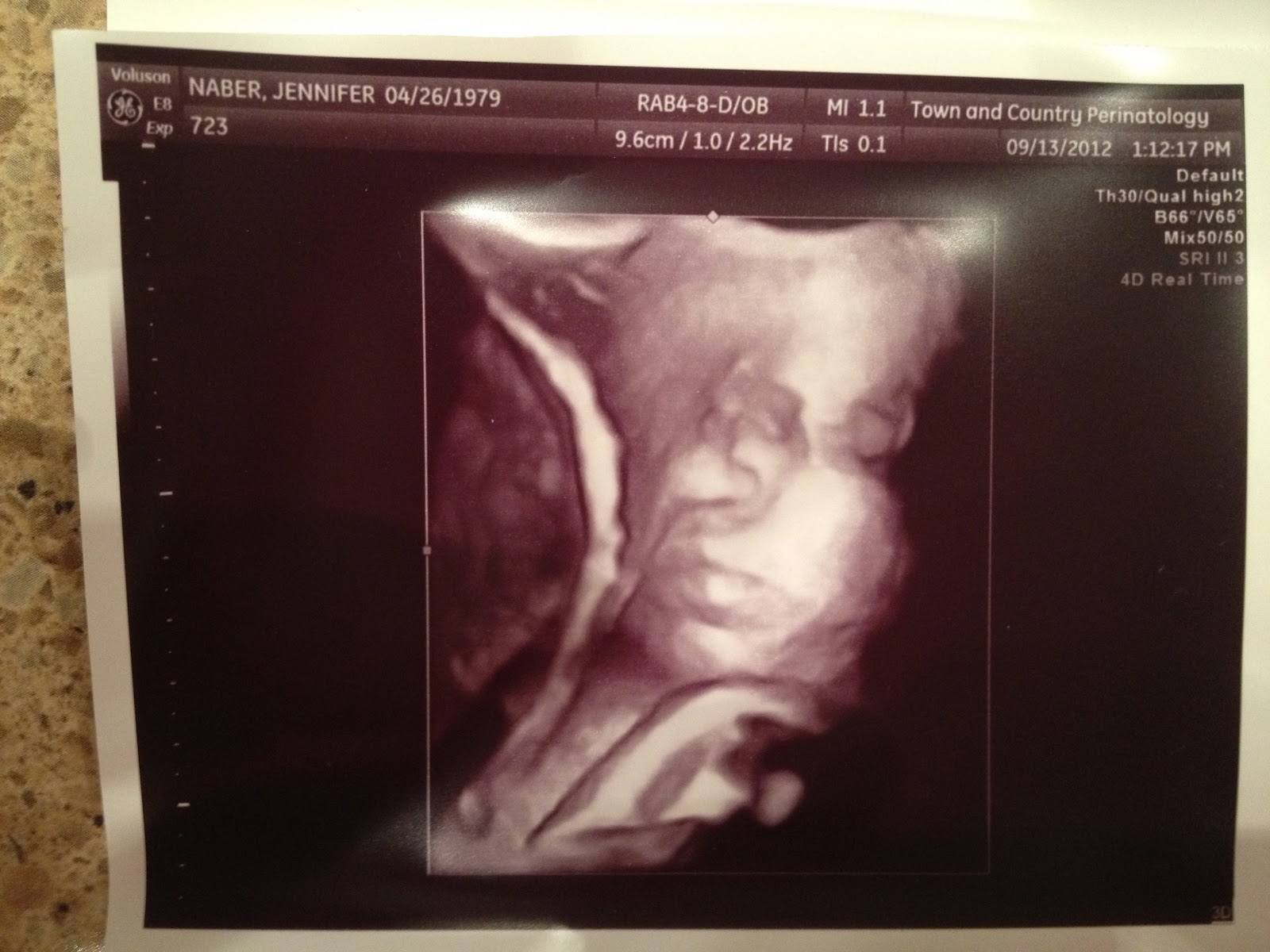 Our journey to be parents: 34 weeks pregnant