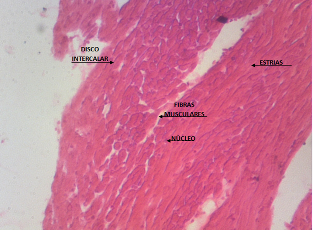 TEJIDO MUSCULAR Y CARTILAGINOSO: TEJIDO MUSCULAR