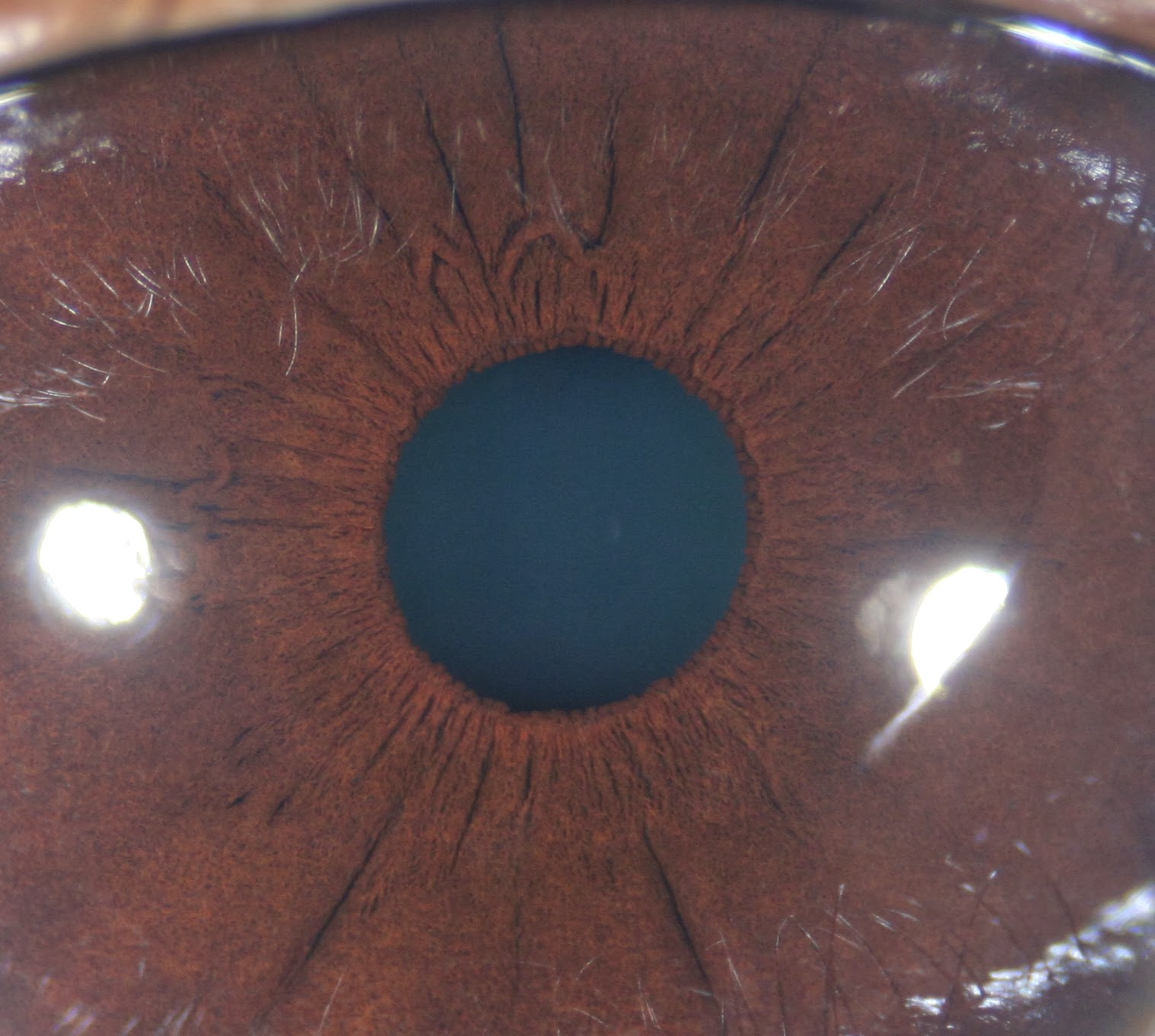 Modern & Multidimensional Iridology: IPB Morphologies, Pupil Flatness ...