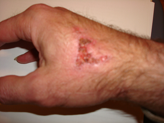 RUNAWAY SLAVE: Post-Concussion Rants Of A Deported Asylum Seeker: The ...