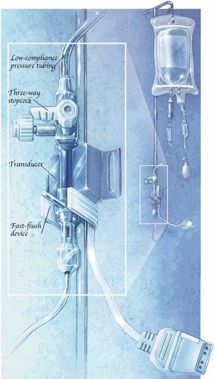 Fluid Filled Monitoring System (Scientific Principles). ppt | Free ...