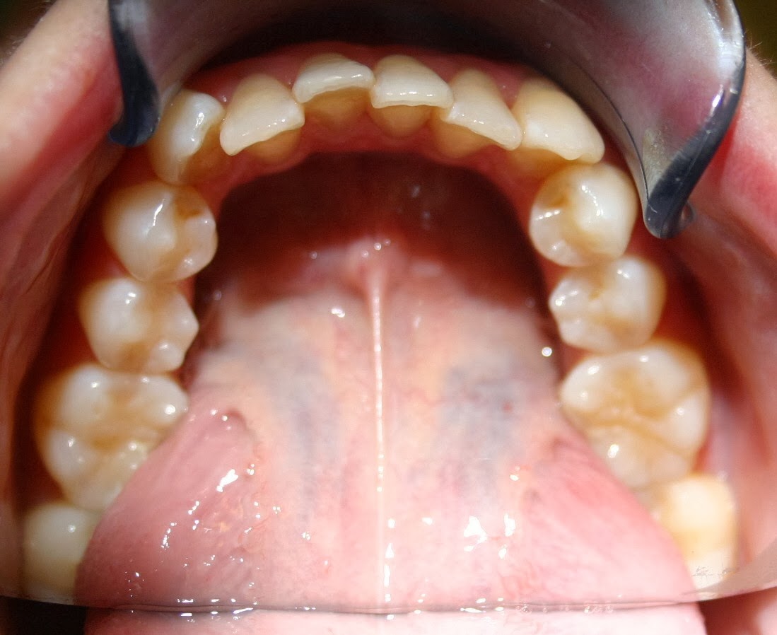 Crescent Dental on Blogspot!