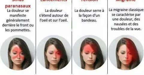 Médical & Paramédical : Les céphalées : Définition, causes, symptômes ...