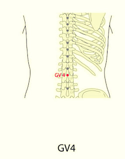 SaroEpic Acupuncture : Acupuncture Points for Polycystic Ovarian ...