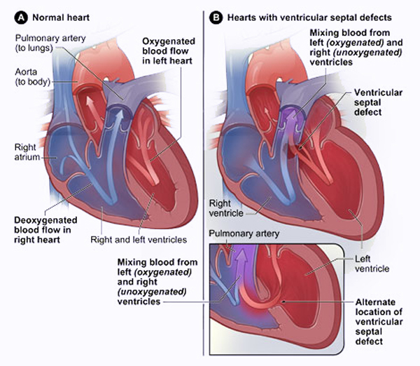 Medical Lecture Notes: Cardiovascular Congenital Deformities