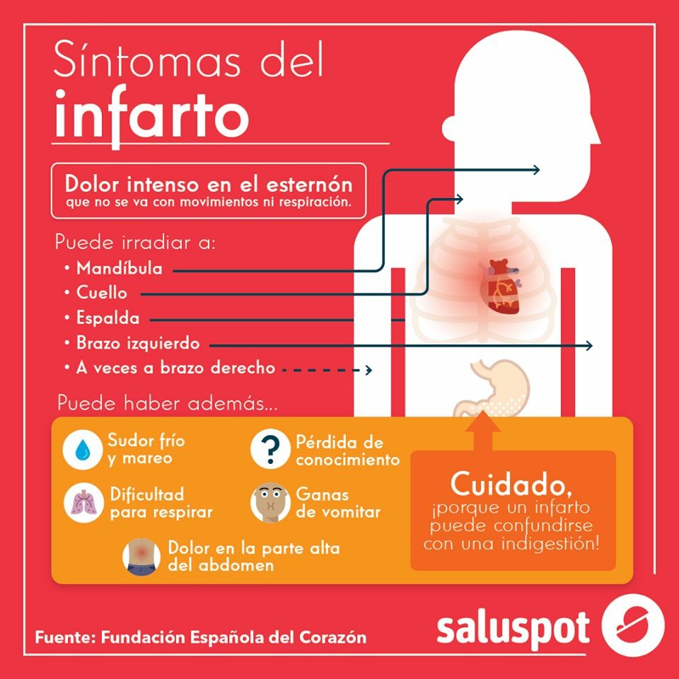 Cuidados y Tecnicas de Enfermería: Síntomas del Infarto.