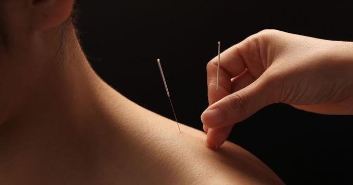 Theory Converted: Rotator Cuff Tear (Supraspinatus Muscle) - Private ...