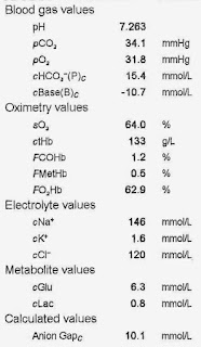 ECG of the Week: ECG of the Week - 11th March 2013 - Interpretation