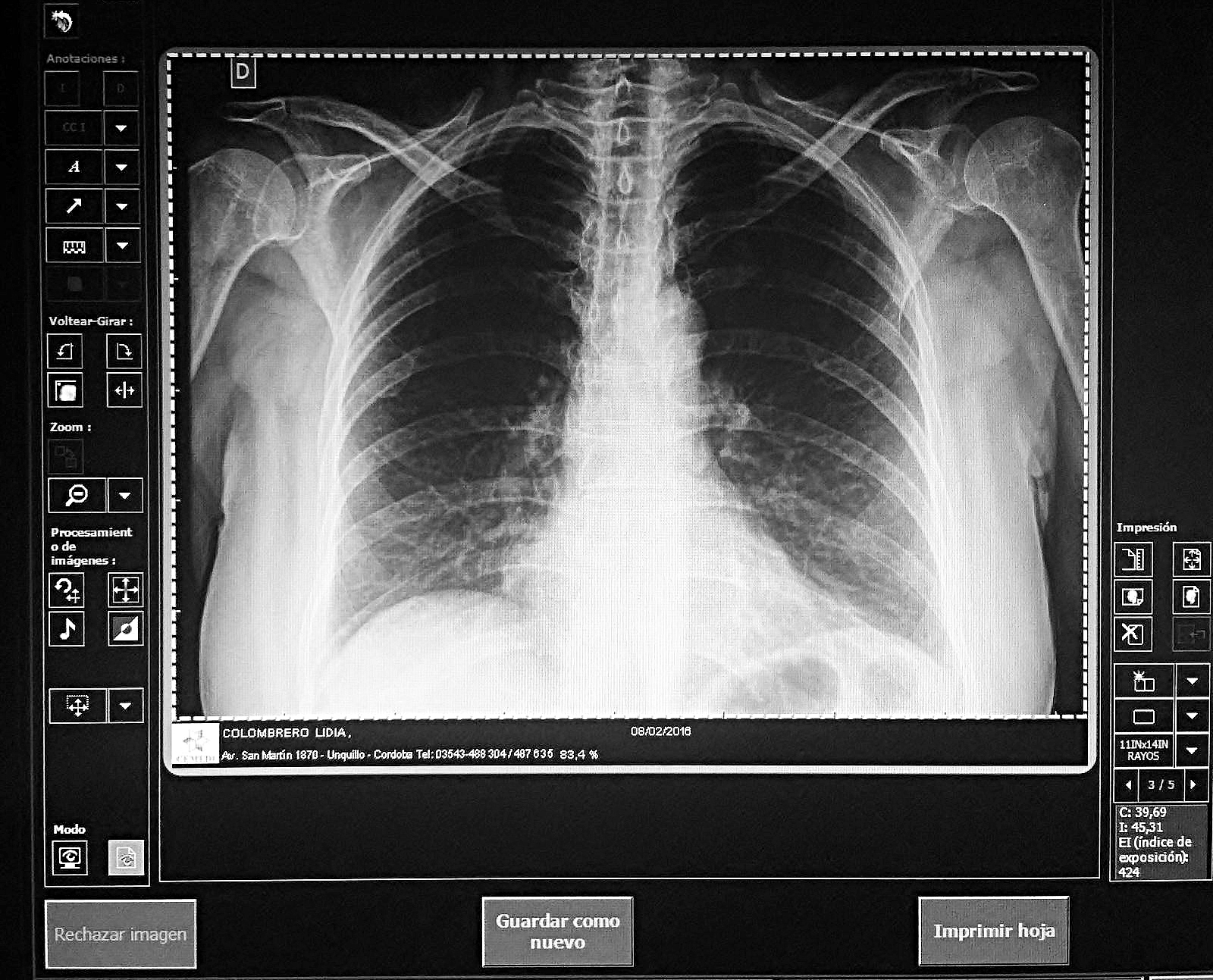 CEMEDI: Radiología digital