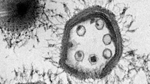 Los 8 récord Guinness del mundo microscópico - Resolviendo la incógnita