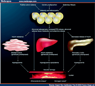 Hypertriglyceridemia | The Ultimate Curiosity