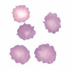 Celulas Sanguineas: Atlas de hematología: Anormalidades serie eritroide.