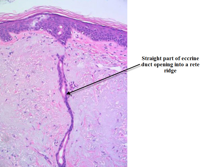 Dermatopathology Made Simple - Inflammatory: Introduction to skin ...
