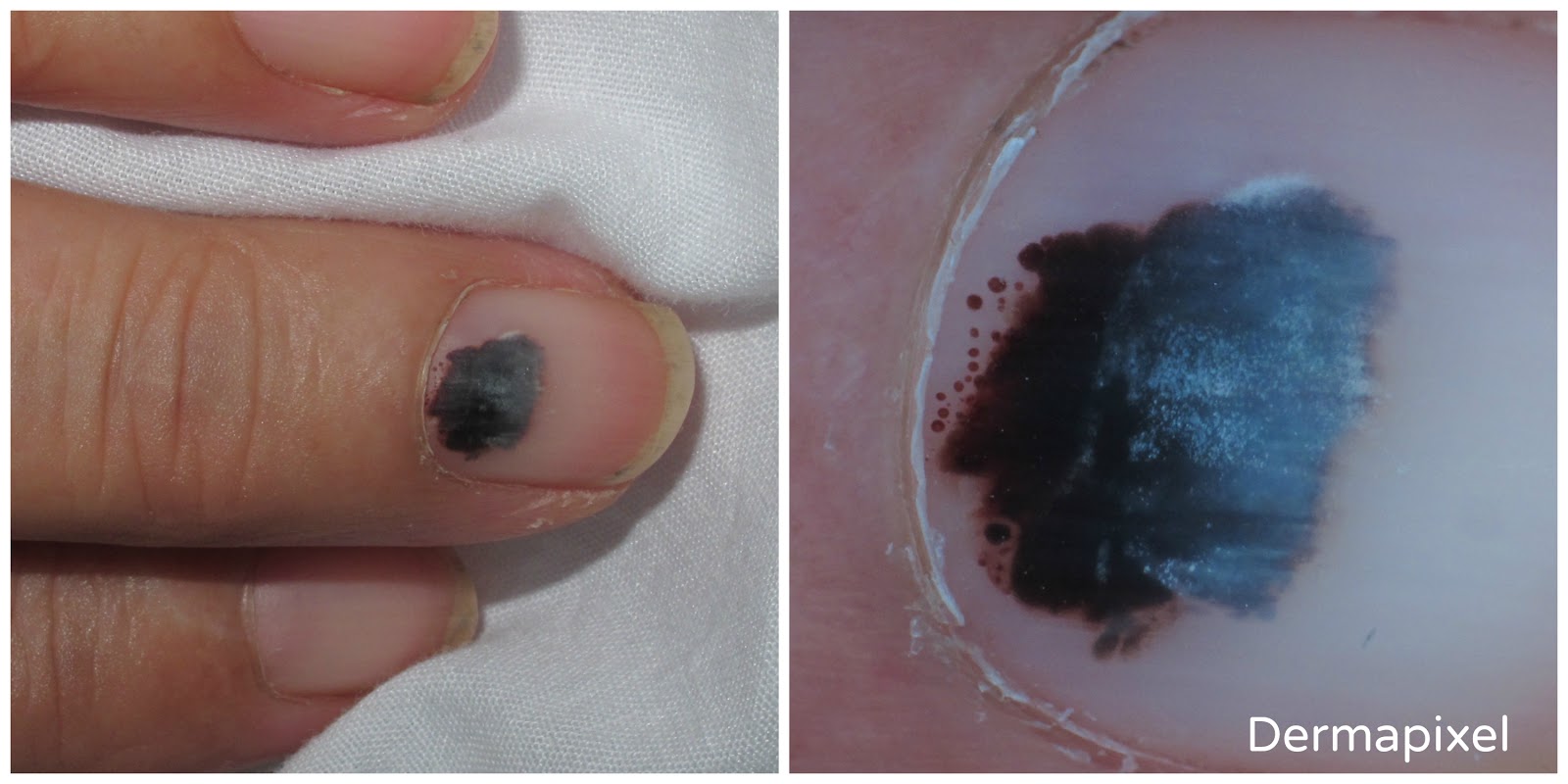 Dermapixel: agosto 2017