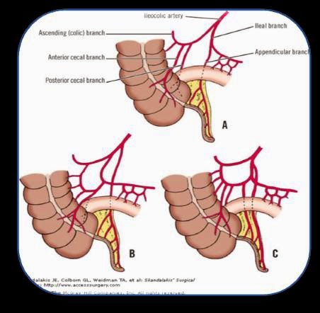 DR. JUAN HERNÁNDEZ ORDUÑA. : Anatomía quirúrgica del apéndice texto