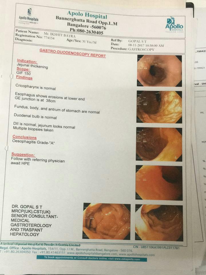 Sushrut Yog Research Center: Severe Abdomen Pain due to Acute ...
