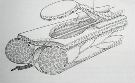 GENERAL SURGEON: GROIN FLAP