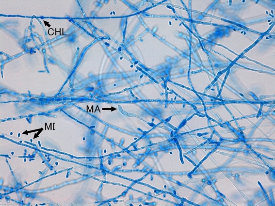 Fun With Microbiology (What's Buggin' You?): Trichophyton tonsurans