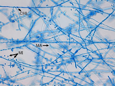 Fun With Microbiology (What's Buggin' You?): Trichophyton tonsurans
