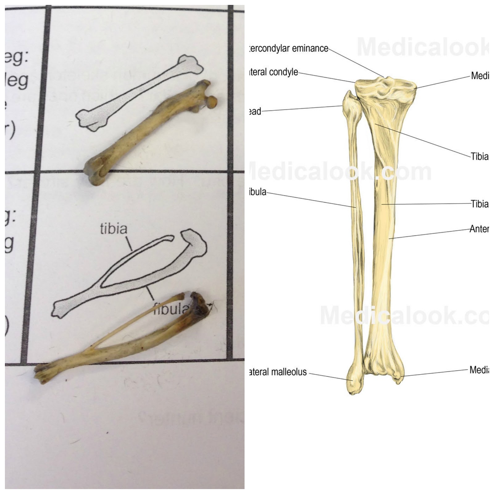 The Best of Anatomy: Owl Pellet Dissection