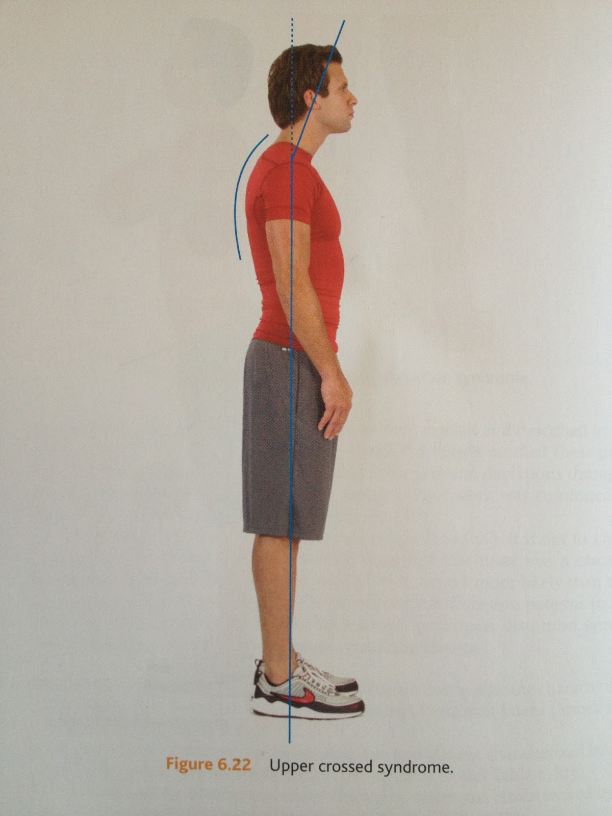 The Aging Athlete: Cycling Posture