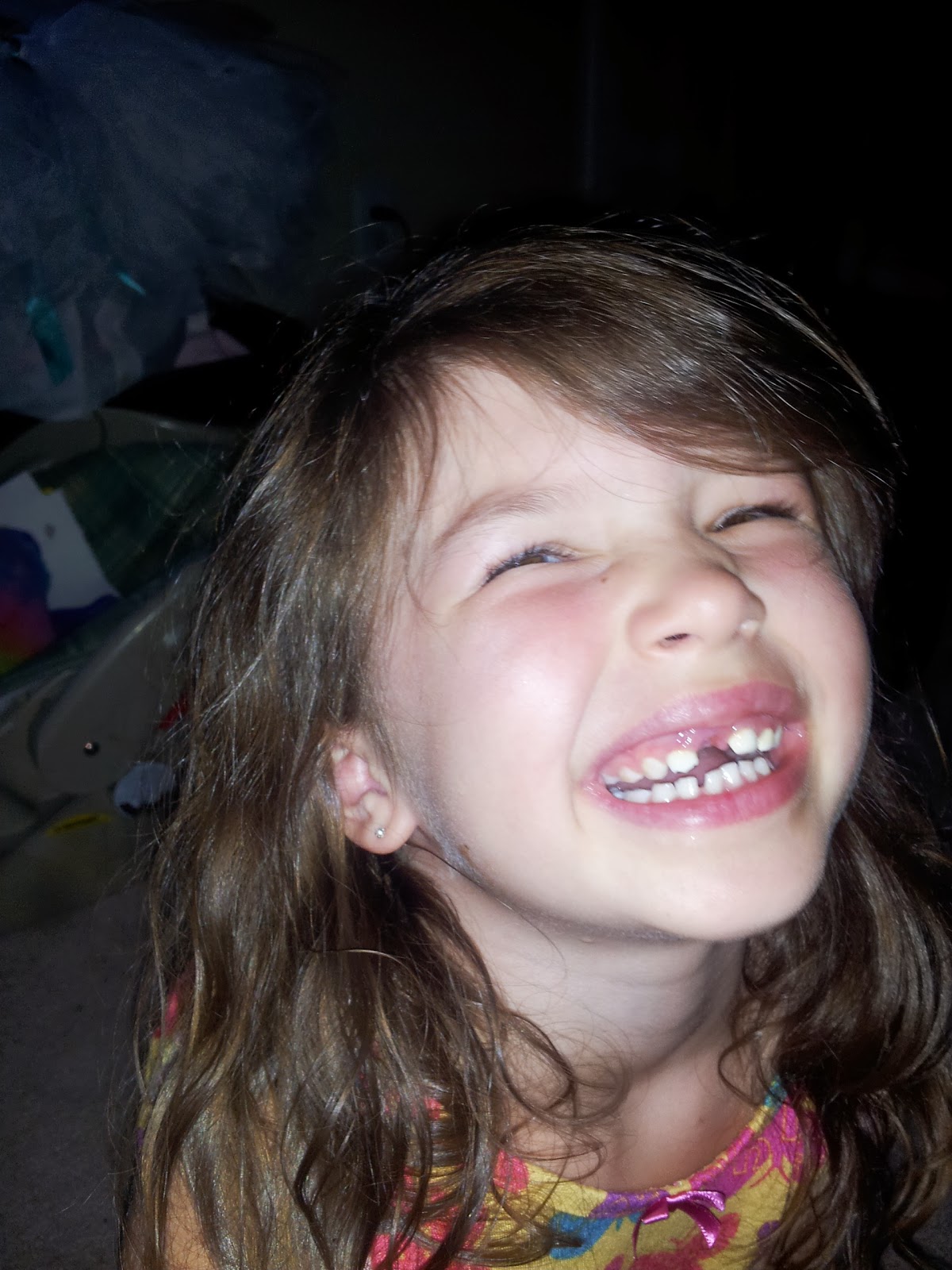 Just Wait And See Chloe Lost Her First Tooth