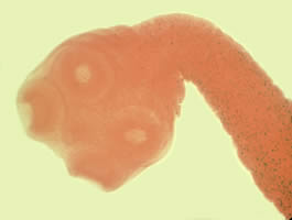 teniasis