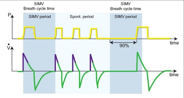 Class learning in Ventilator mode