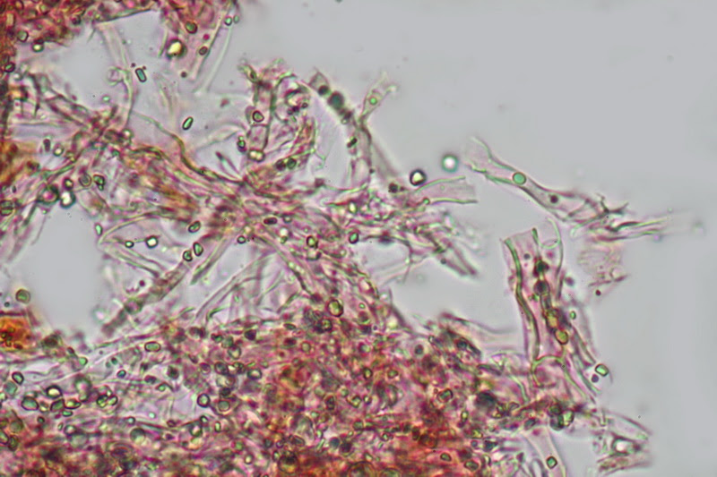 El mundo microscópico de los hongos: Coniophora puteana (Schum. Ex Fr ...