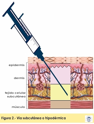 Heredia_Sanchez_Alfredo: Tipos de inyección