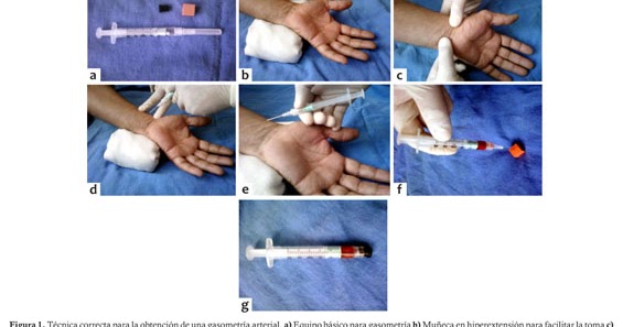 estrategias de intervención cardiopulmonar