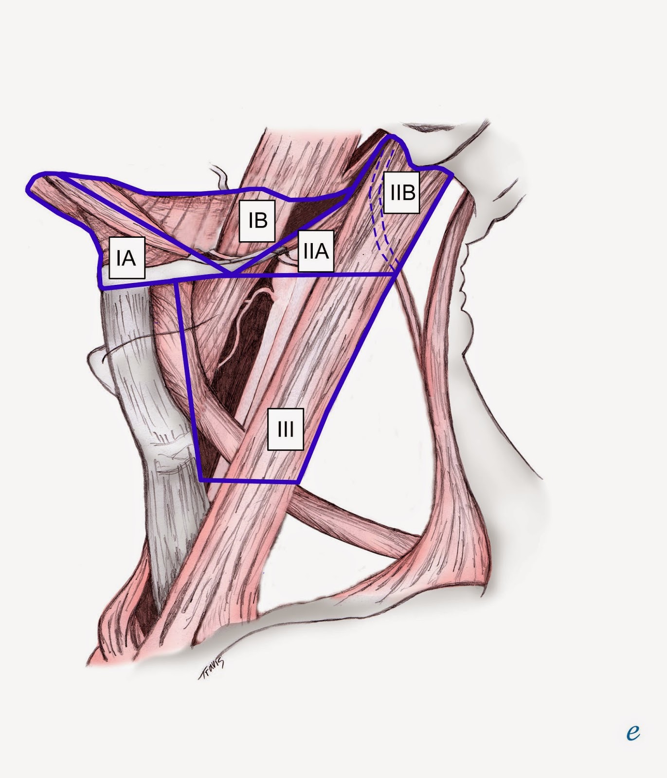 Miles To Read B4 I Sleep Level 2 A And 2b Cervical Lymph Node Cv Ln Levels