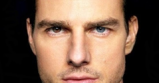 Et si toute les célébrités avaient les yeux vairons - IMAGE D'AMOUR