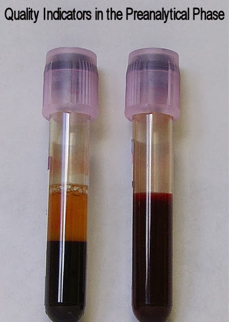 Medical Laboratory and Biomedical Science: Quality Indicators in the ...