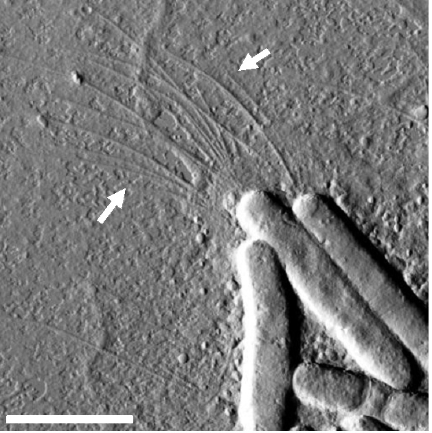 News in Proteomics Research: Phosphoproteomics of Type 4 Pilus construction