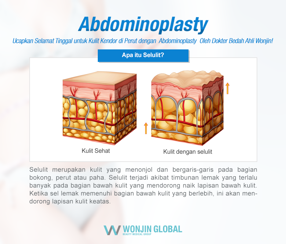 Ucapkan Selamat Tinggal untuk Kulit Kendor di Perut dengan ...