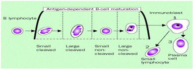Pathology Cases: lymphoma review