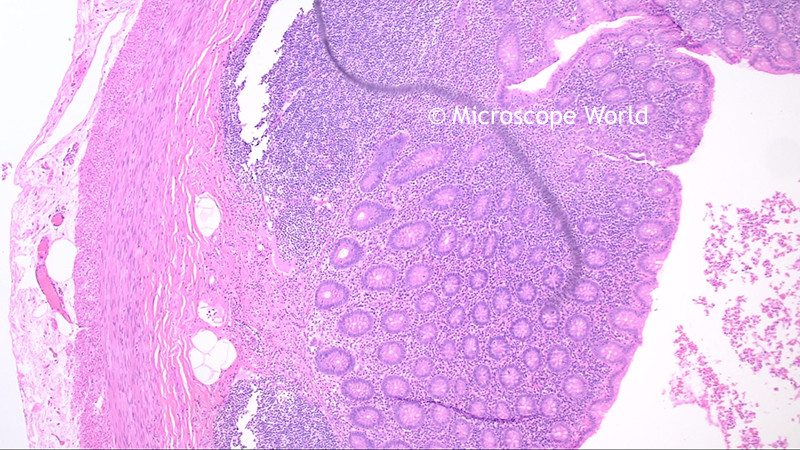 Microscope World Blog: Appendix under the Microscope