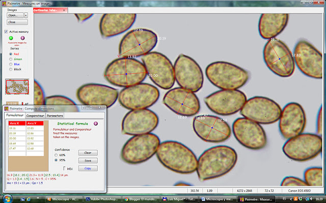 El mundo microscópico de los hongos: El Microscopio