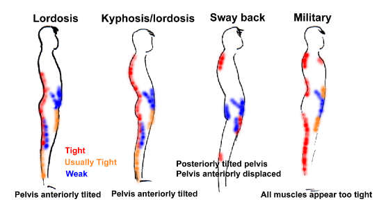Muscle Activation: Posture & Stretching
