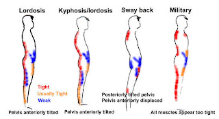 Muscle Activation: Posture & Stretching
