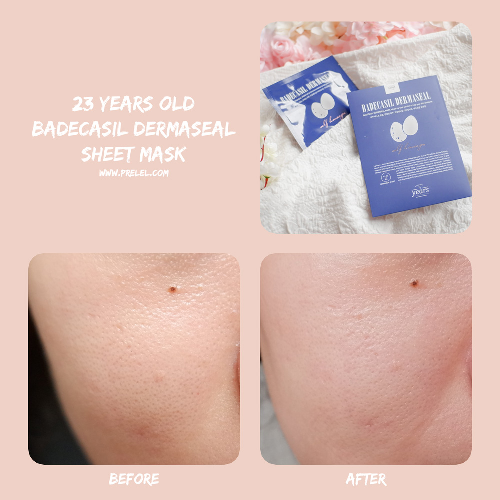 23 Years Old Badecasil Dermaseal Sheet Mask Review