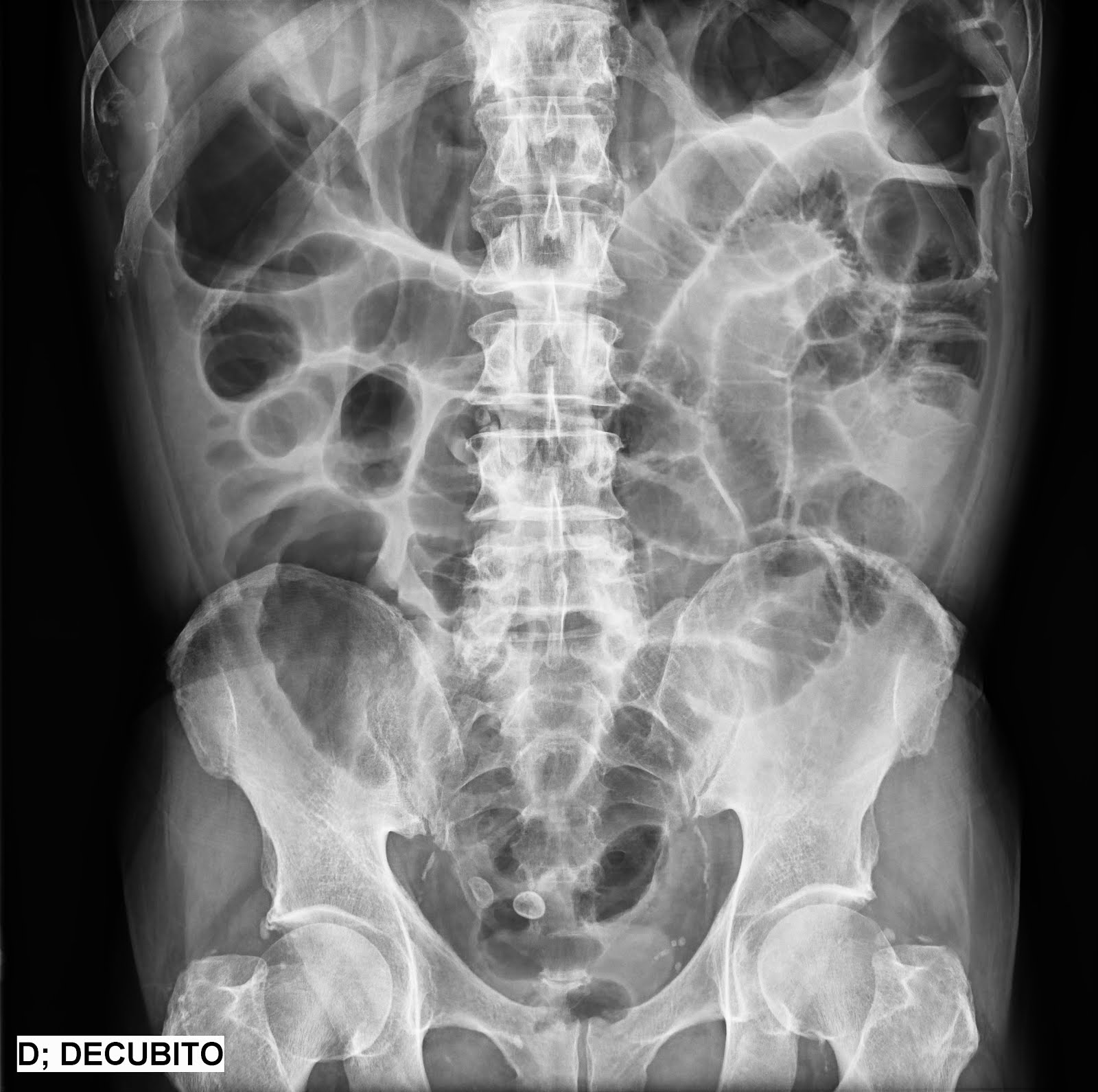 Anatomía radiológica – Abdomen y pelvis