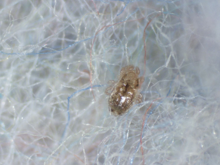 Creepy Dreadful Wonderful Parasites: Case of the Week 217