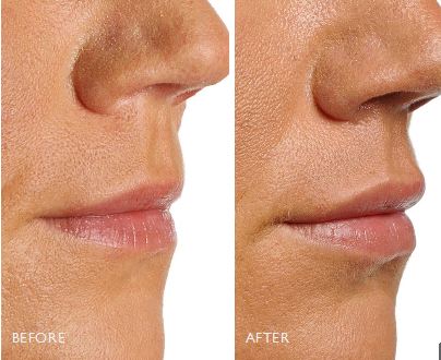 The Jade Lotus : Forget about Trout Pout - New Age Lips