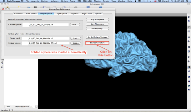 Neuroimaging Made Easy : Brainvoyager QX tips and tricks 1; Some ...