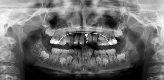 Avery Orthodontics: The Art, Science and Excitement of Orthodontic ...