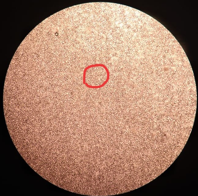 BENDA ERGASTIK ALEURON PADA TUMBUHAN