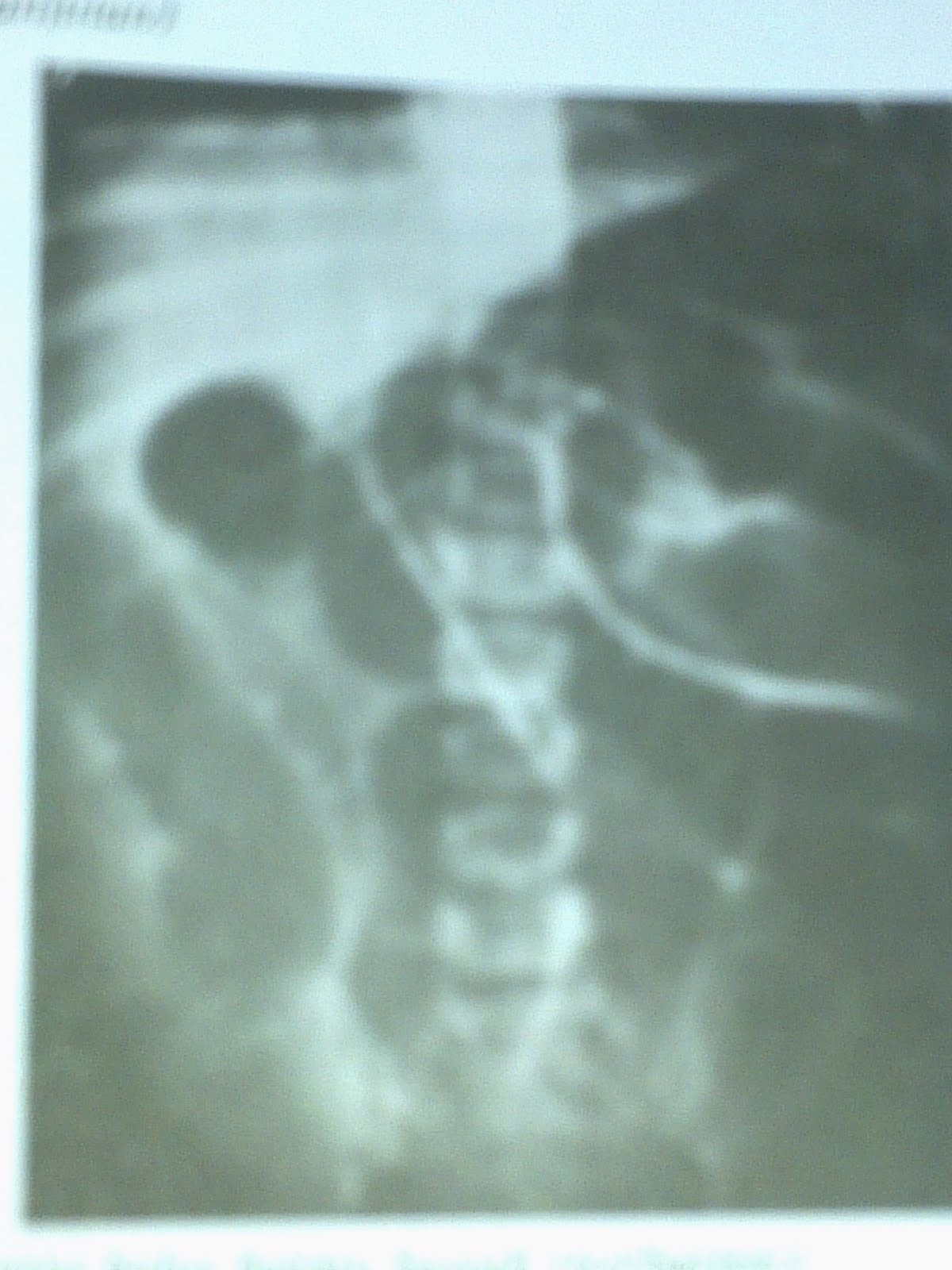 ChyntiaBlog: Radiologi Abdomen dan Urogenital