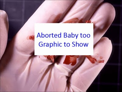 The Pictures The Gov't Doesn't Want You To See| National Catholic Register